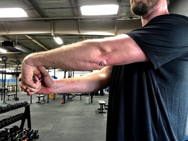 How To Stop Elbow Pain While Lifting - Larson Sports and Orthopaedics