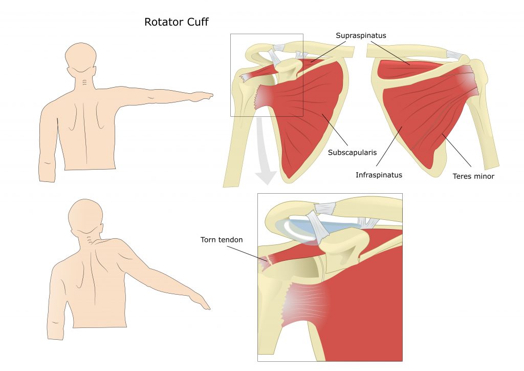 What Is the Rotator Cuff? - Larson Sports and Orthopaedics